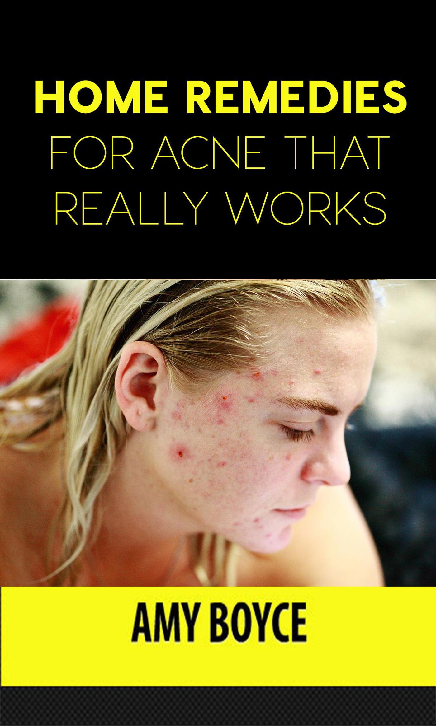 Smashwords – Home Remedies for Acne That Really Works – a book by Amy Boyce
