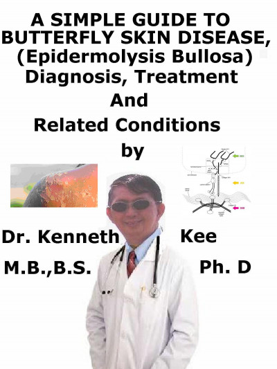 Smashwords – A Simple Guide to Butterfly Skin Disease (Epidermolysis ...