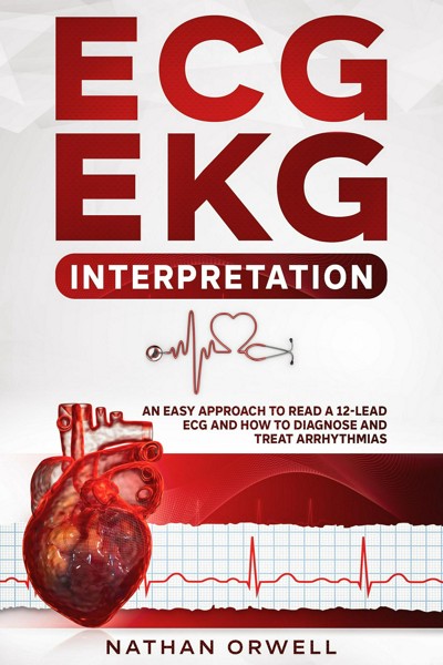 Smashwords – ECG/EKG Interpretation: An Easy Approach to Read a 12-Lead ...